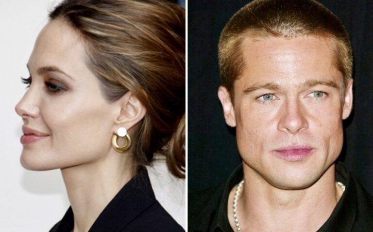 Q&A: "Celebrity Jawline"? - Body Sculpting with Orthosculpt